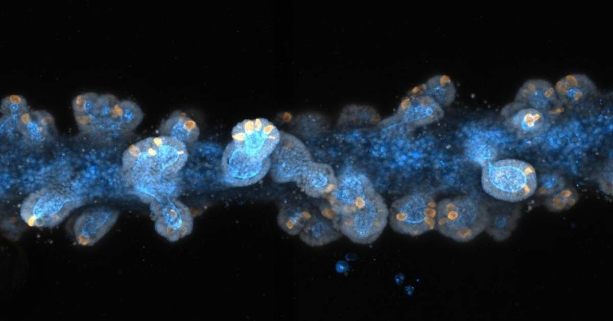 Mini-Organe aus dem 3D-Drucker - computerworld.ch