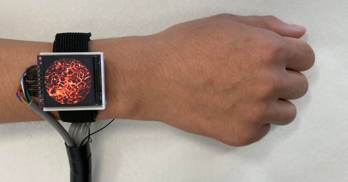 Neue "Smartwatch" zeigt, wie fit das Herz ist - computerworld.ch